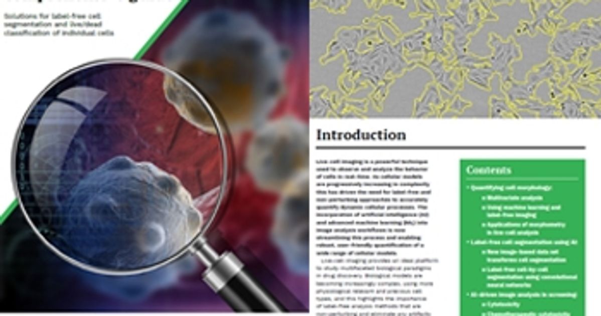 Artificial intelligence enhances label-free live-cell imaging