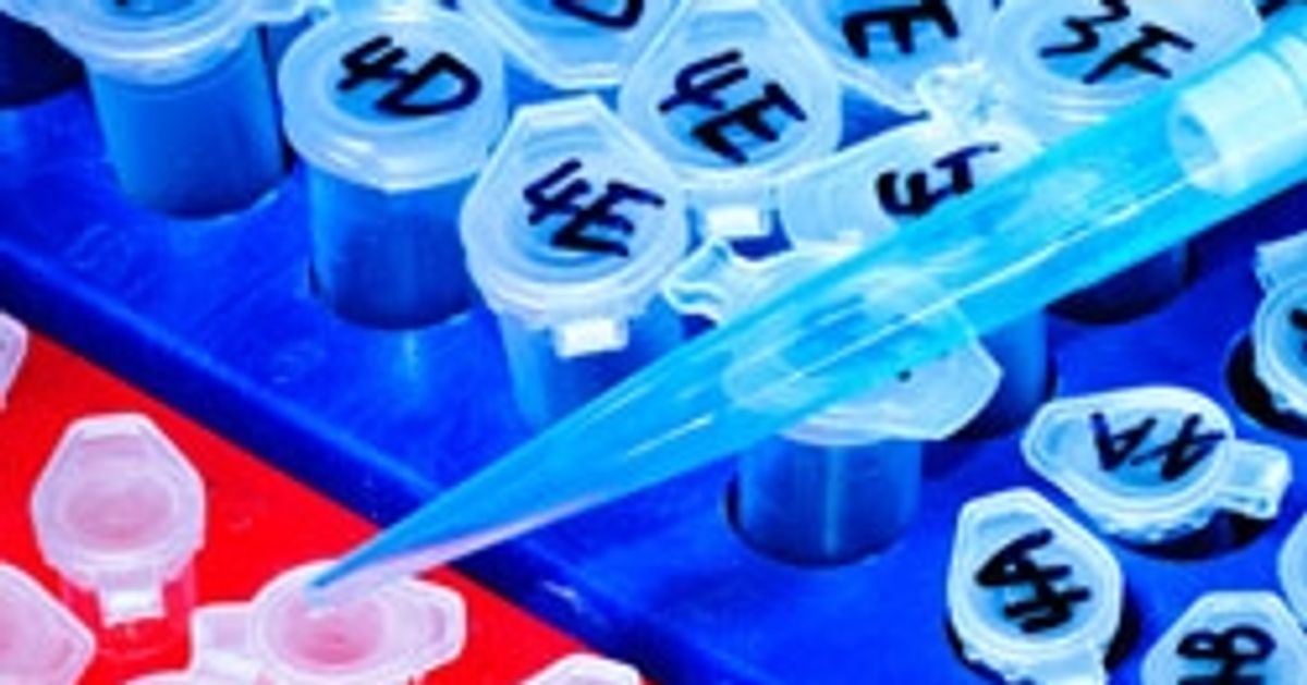 Genetic Analysis DNA-Based GA-Map™ IBS Dysbiosis Test Receives CE Mark ...