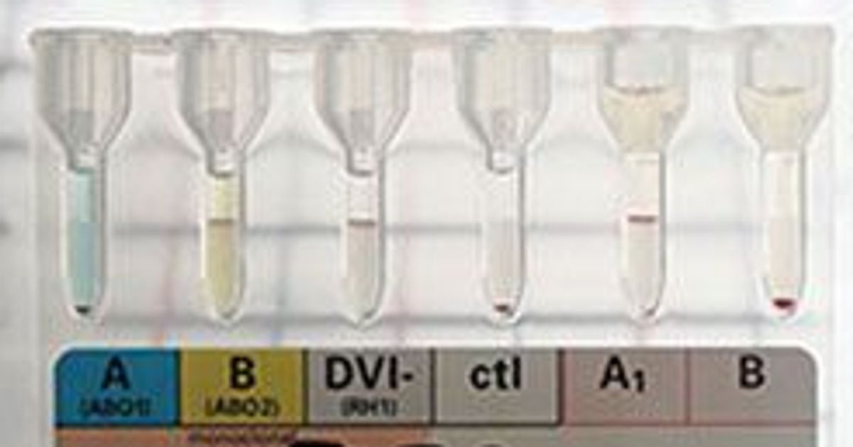 New ALBAcyte® 0.8% Reagent Red Cell Panels from Alpha Laboratories