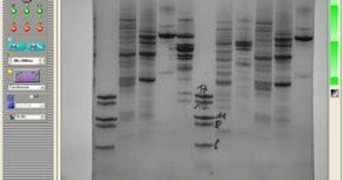 New GeneSnap Image Acquisition Software Promises Reproducible Gel ...