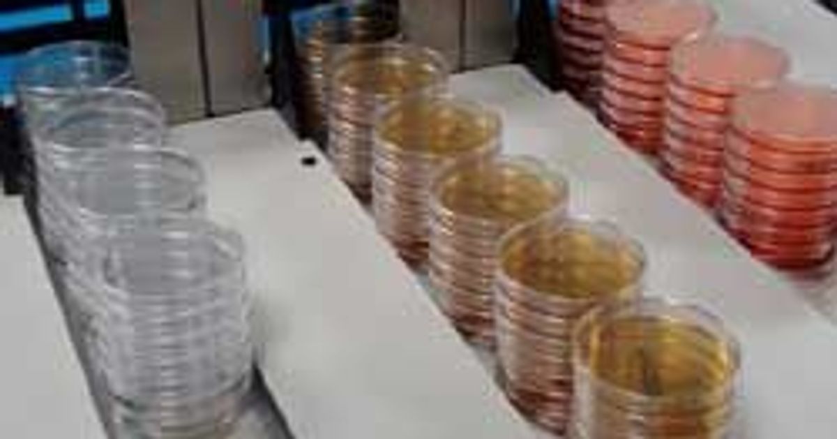 Automate the Transportation of Petri Dishes from Receipt of Sample to ...
