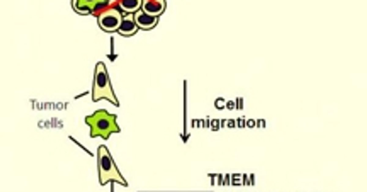 New Diagnostic Test for Cancer Metastasis