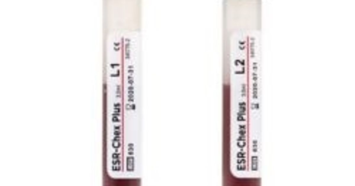 ESR-Chex® Plus reviews