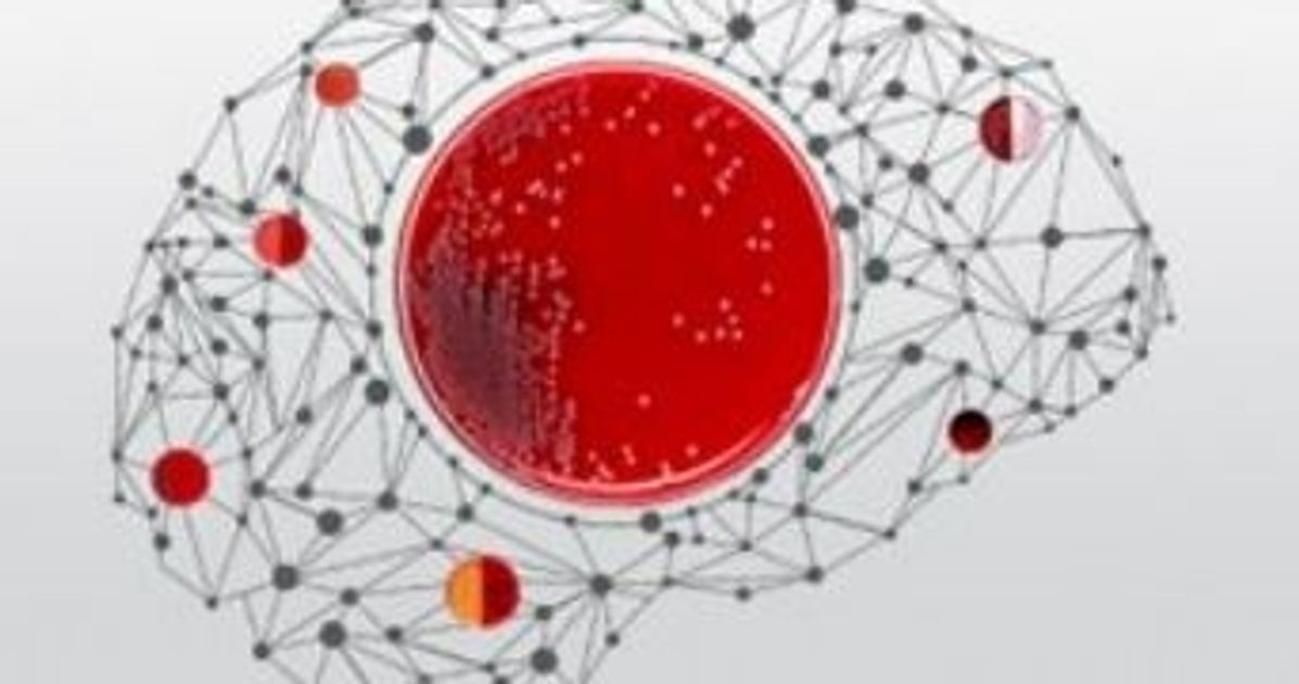 SmartPlate format for Thermo Scientific™ Remel™ and Oxoid™ prepared ...