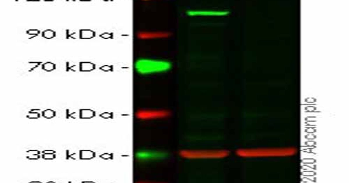Human ACTN1 (alpha Actinin) knockout HeLa cell line | SelectScience
