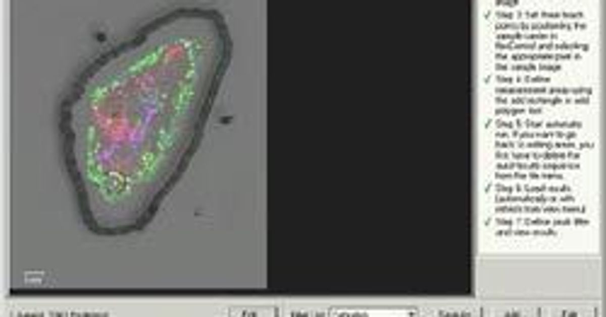 Bruker Significantly Strengthens Its Industry Leading MALDI Molecular ...