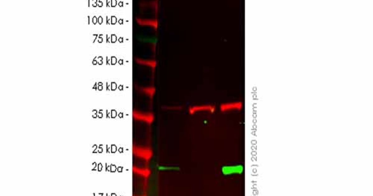 Human FTH1 knockout HEK293T cell line | SelectScience