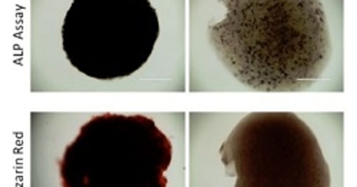 Plasticell Collaborates with Cellspring to Develop Osteogenic Cell ...