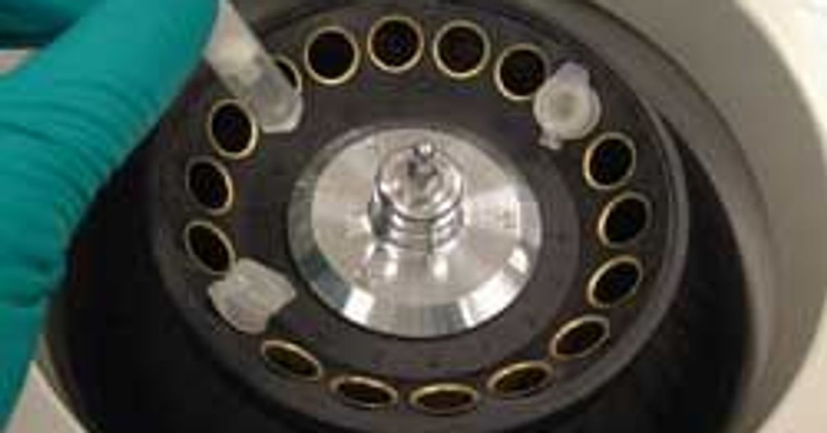 Highly Sensitive & Specific Chromatin Immunoprecipitation (ChIP) Assay ...