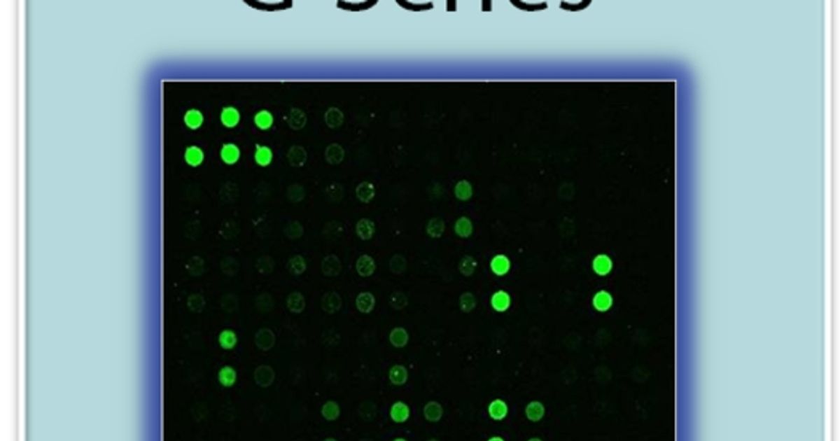 Buy Human Protein Acetylation Array G1 Read Reviews