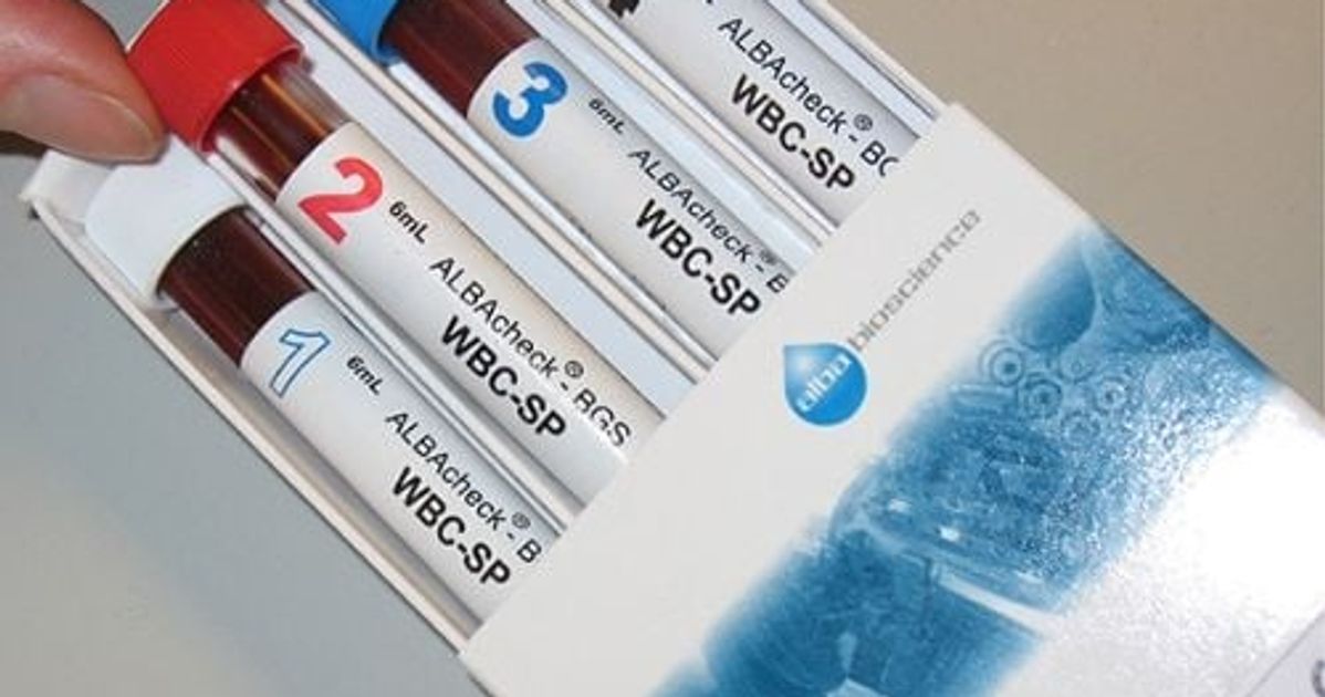 ALBAcheck® Whole Blood Controls reviews