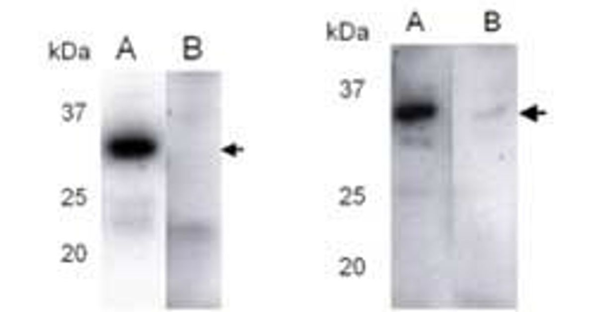 AnaSpec Introduces New Z-Fish™ Antibodies for Cell Cycle Control Research