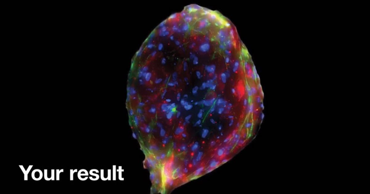 Magnetic 3D Bioprinting of Spheroids