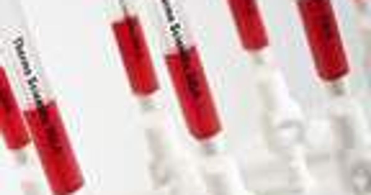 Thermo Fisher Solid Phase Extraction Sample Preparation Products Win G ...