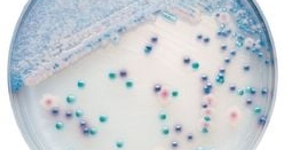 BD BBL™ CHROMagar™ Candida Plate reviews