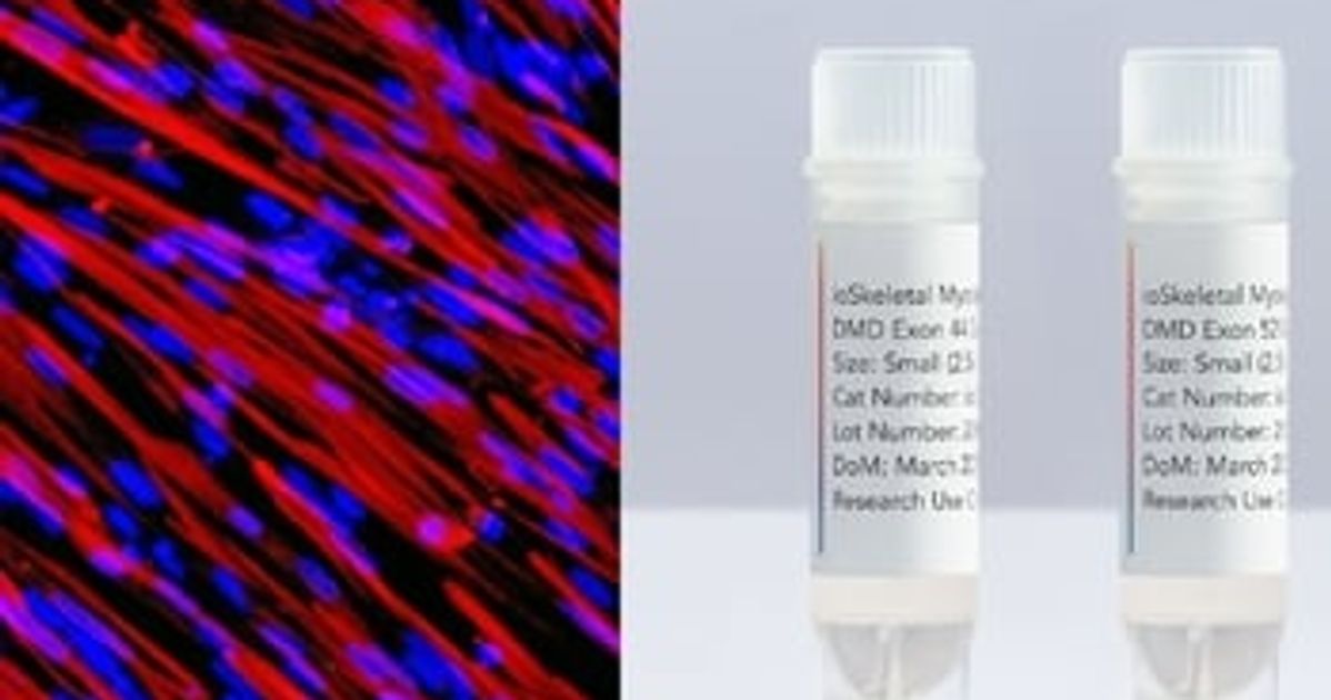 bit.bio launches two new human cell disease models to advance discovery ...