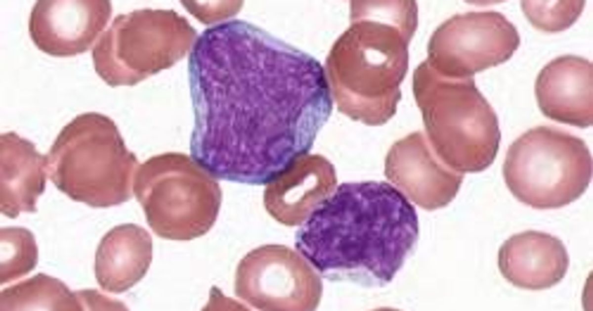 Aperio Introduces High-Resolution Slide Scanning for Haematology