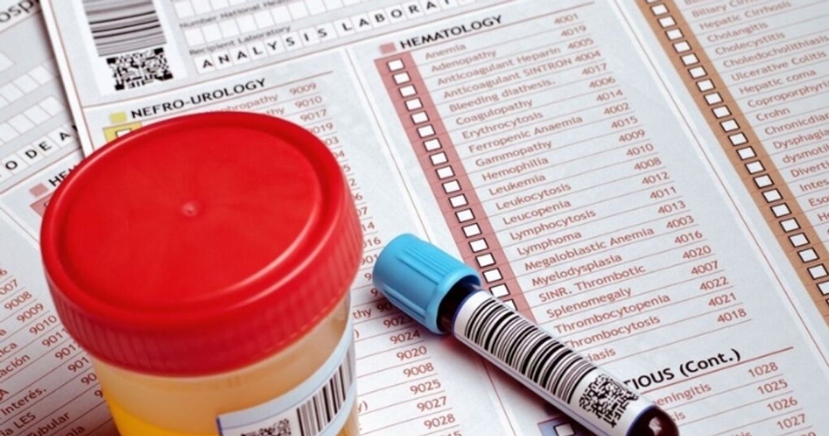 Lifesaving new drug-checking equipment from Victoria Island University