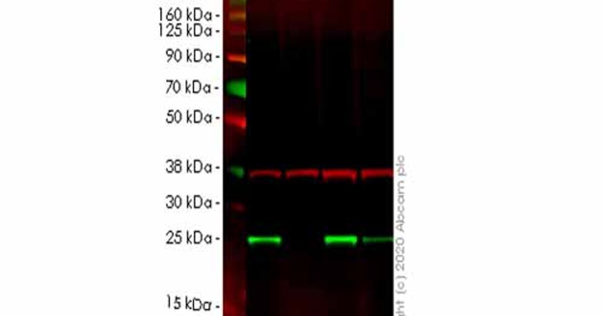 Human UBE2K (HIP2/LIG) knockout HCT116 cell line | SelectScience