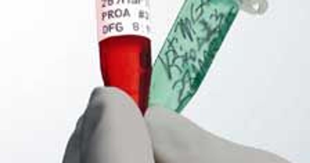 Ensure Sample Integrity and Reduce Legibility Problems