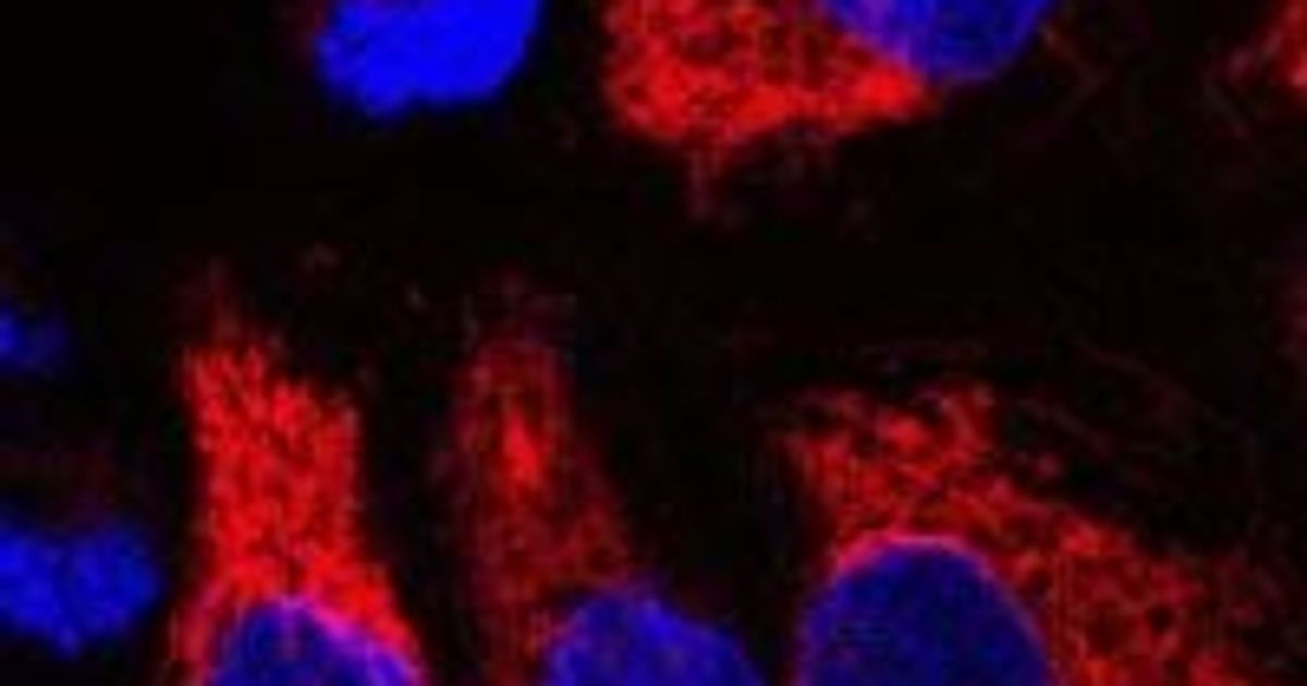 SmartFlare RNA Detection Probes