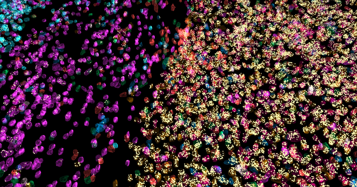 3D spatial transcriptomics transforms understanding of tissue biology
