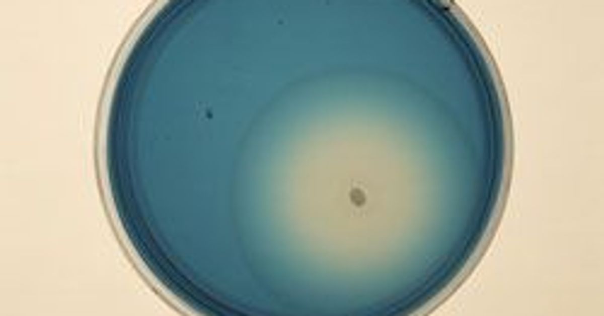 Oxoid Extends Range of ISO Compliant Culture Media for Food and ...