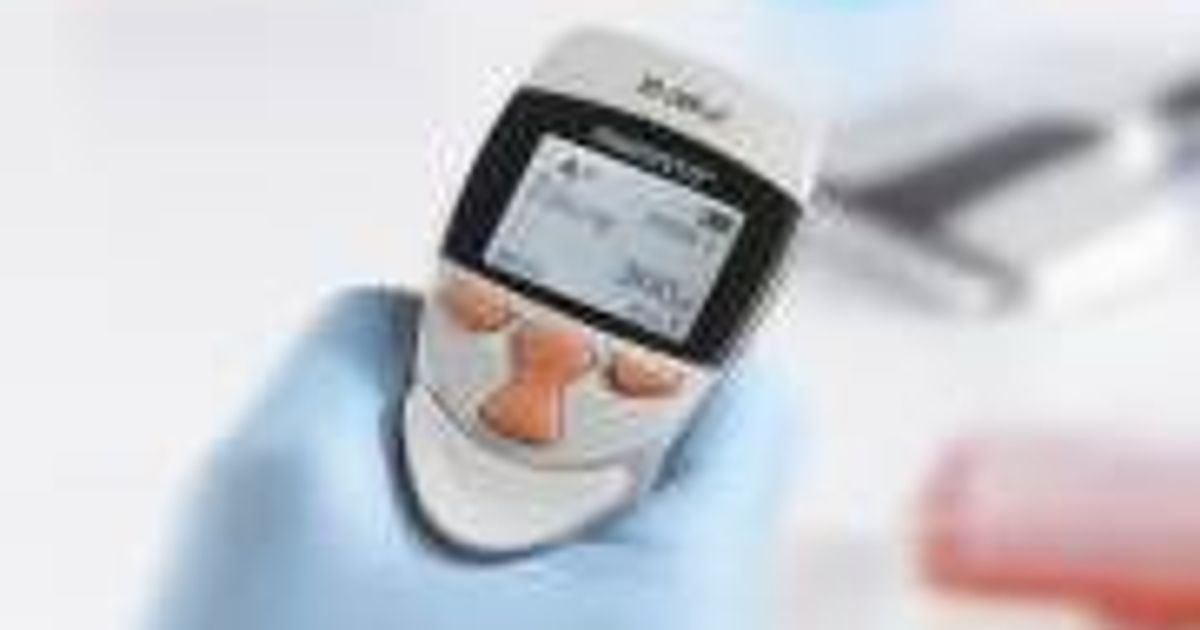 Thermo Enhances the Finnpipette Novus Range