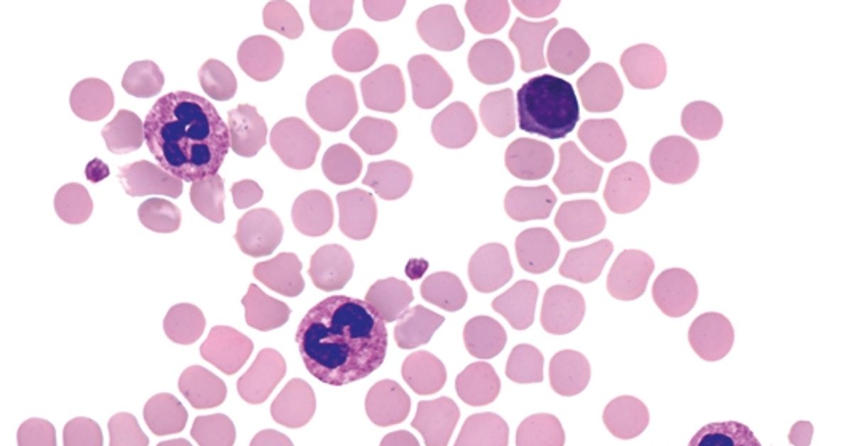 Hematology Staining Solutions