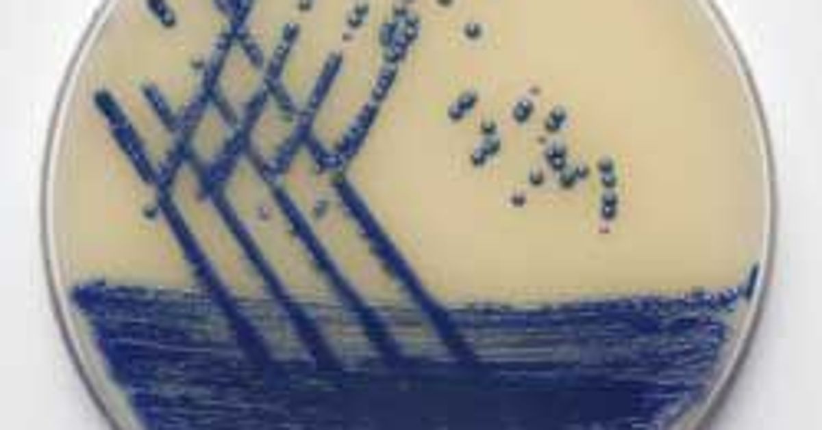 Brilliance MRSA AGAR reviews