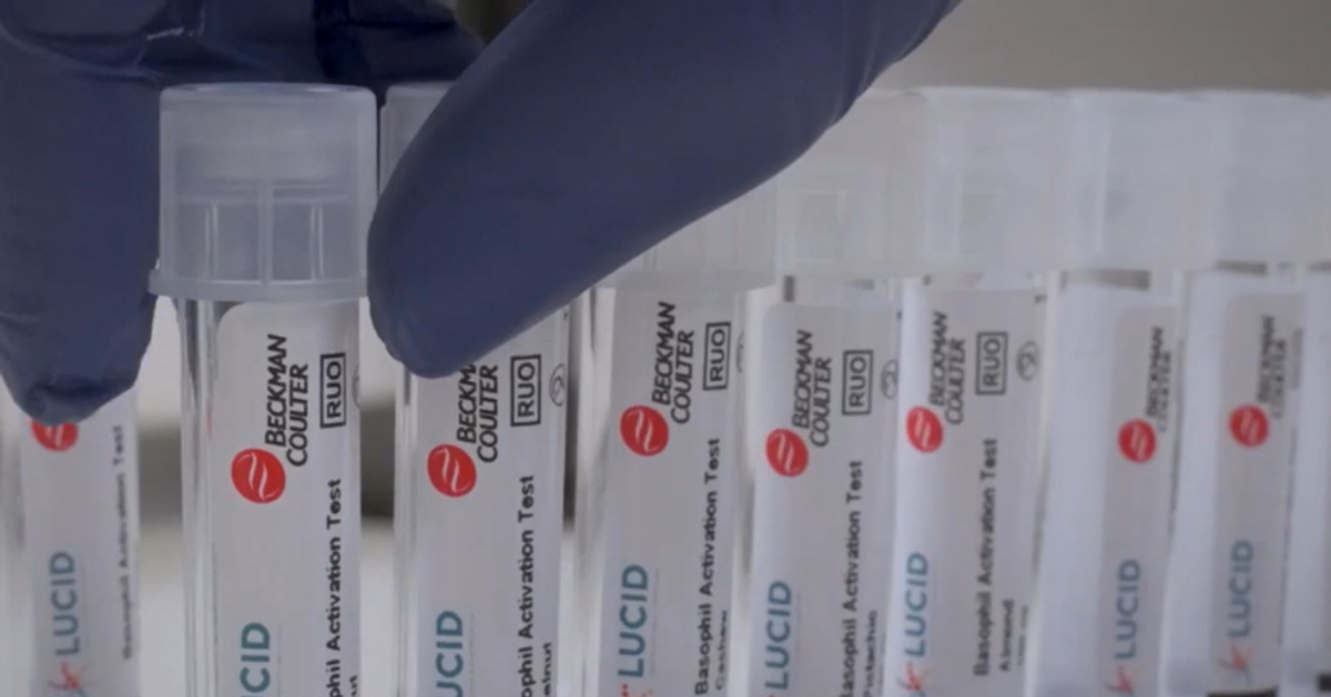 Improving expedite allergy research with the Next-Generation Basophil ...