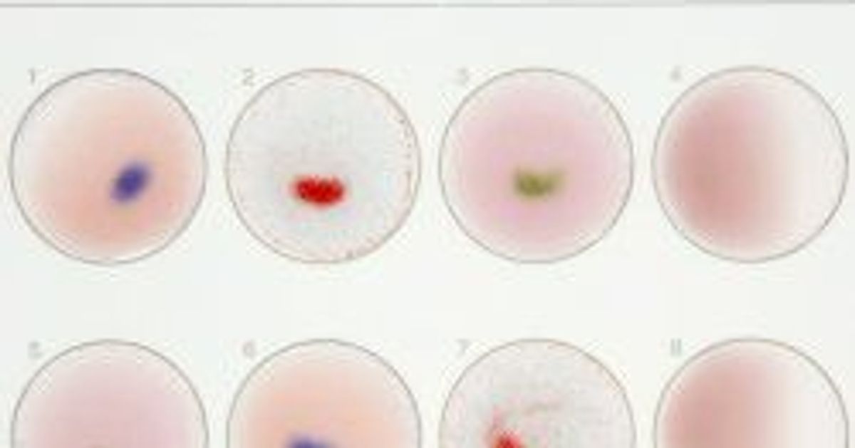 Wellcolex Colour Latex Tests Added to Oxoid Range