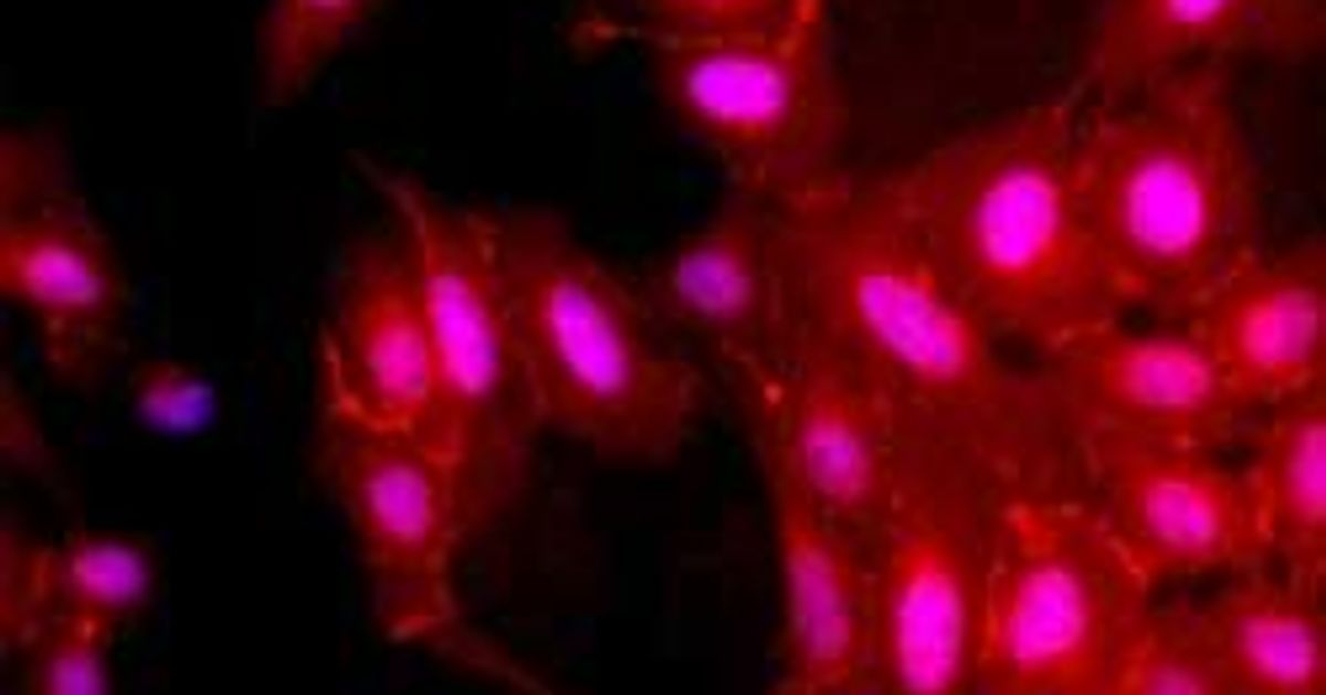 Thermo Fisher Scientific Introduces New Fluorescent Dyes, Conjugates ...