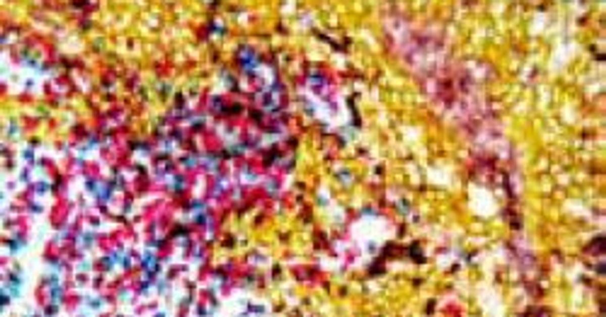 Multiplex Immunohistochemical (IHC) Analysis from Enzo Life Sciences, Inc.