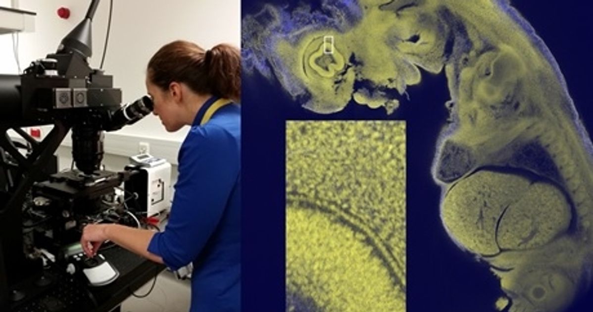Mesolens Ltd. Microscope Enables 3D Imaging of Large Biomedical Specimens