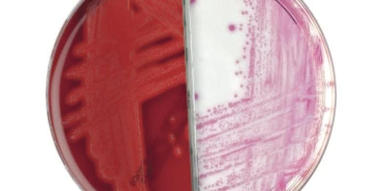 Thermo Scientific™ Oxoid™ Columbia CNA Agar/ Thermo Scientific ...