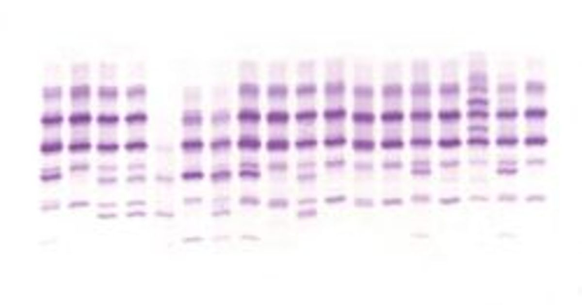 New kit for Alpha 1 Antitrypsin (A1AT) deficiency from Sebia