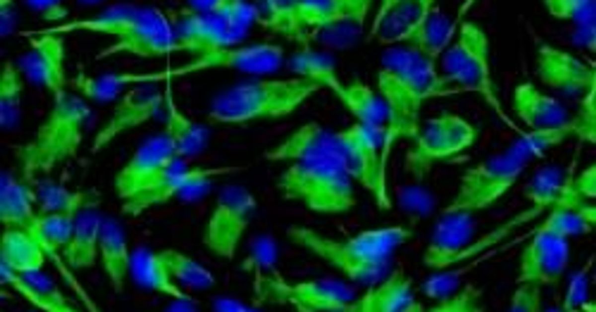 Millipore Releases First Commercially Available Immortalized Human ...