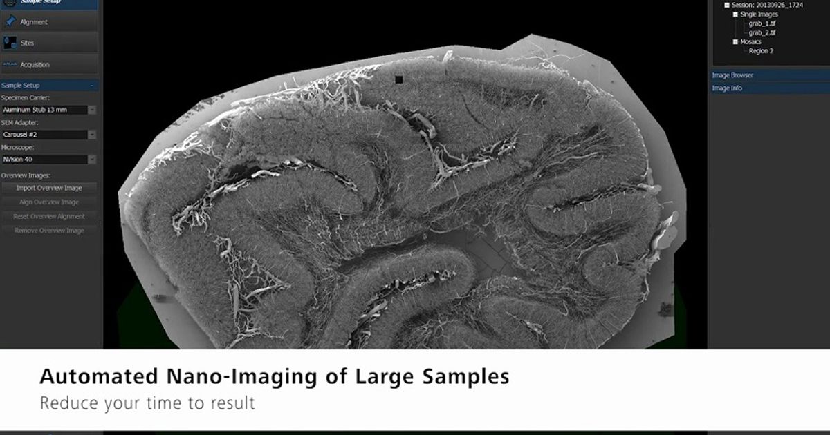 ZEISS Atlas 5 Array Tomography and Correlative Microscopy