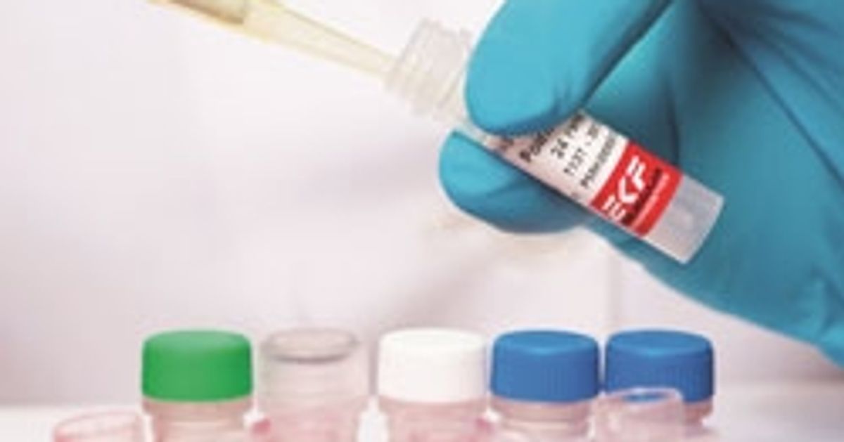 EKF Molecular Diagnostics Collaborates with ANGLE for Liquid Biopsy ...