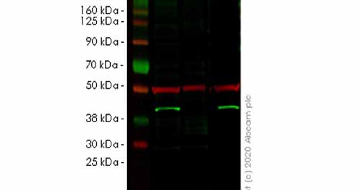 Human HPDL knockout HeLa cell line | SelectScience