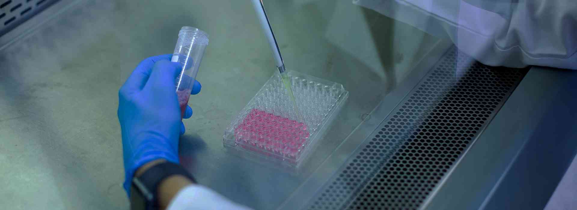 How to troubleshoot microplate assays and optimize detection