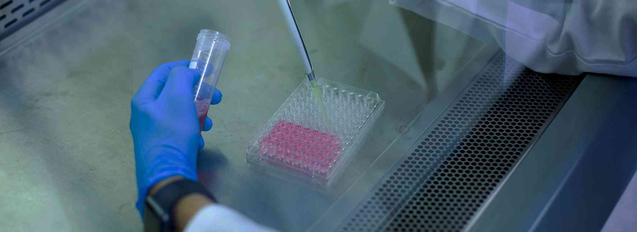 How to troubleshoot microplate assays and optimize detection