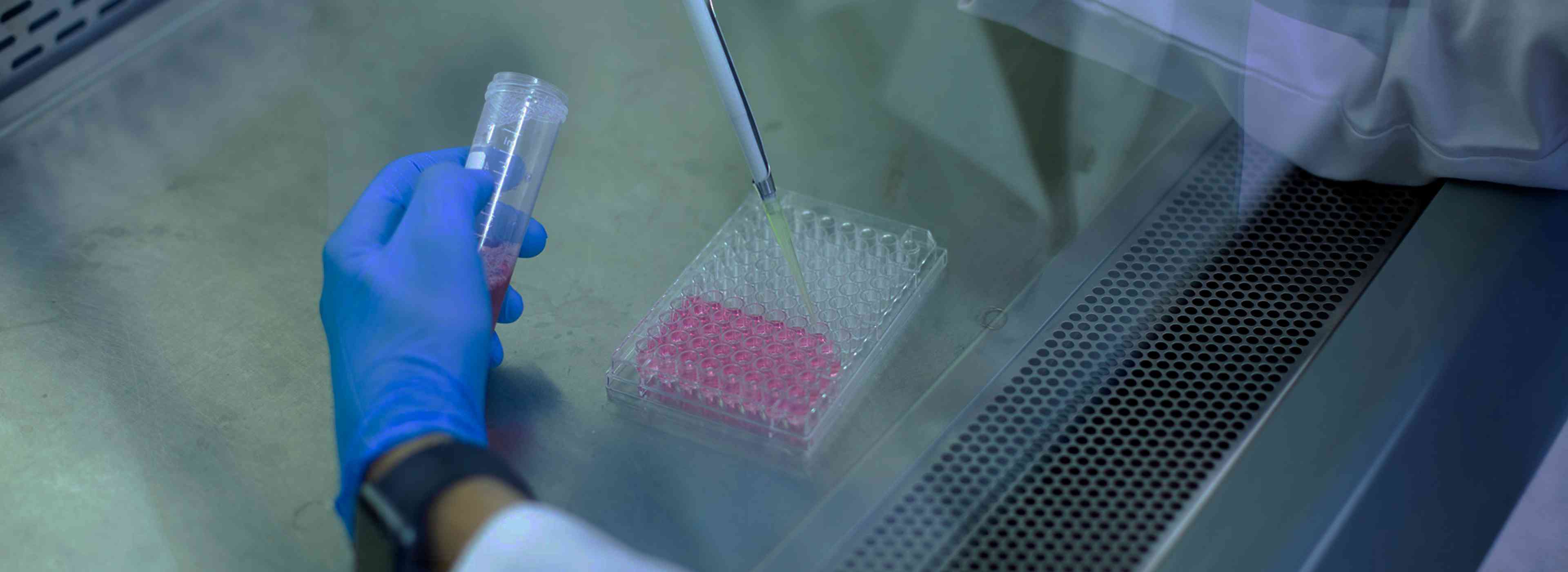 How to troubleshoot microplate assays and optimize detection