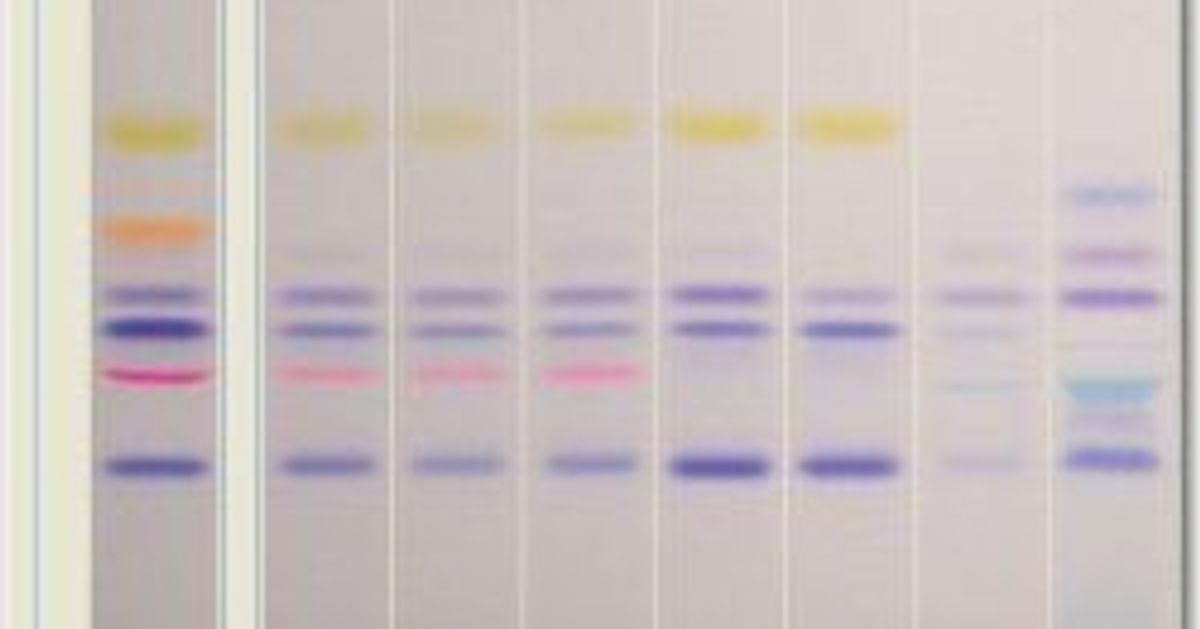 CAMAG is introducing a new software option