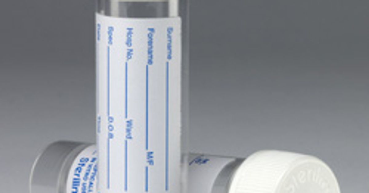 Thermo Fisher Scientific Introduces New Improved Universal Containers