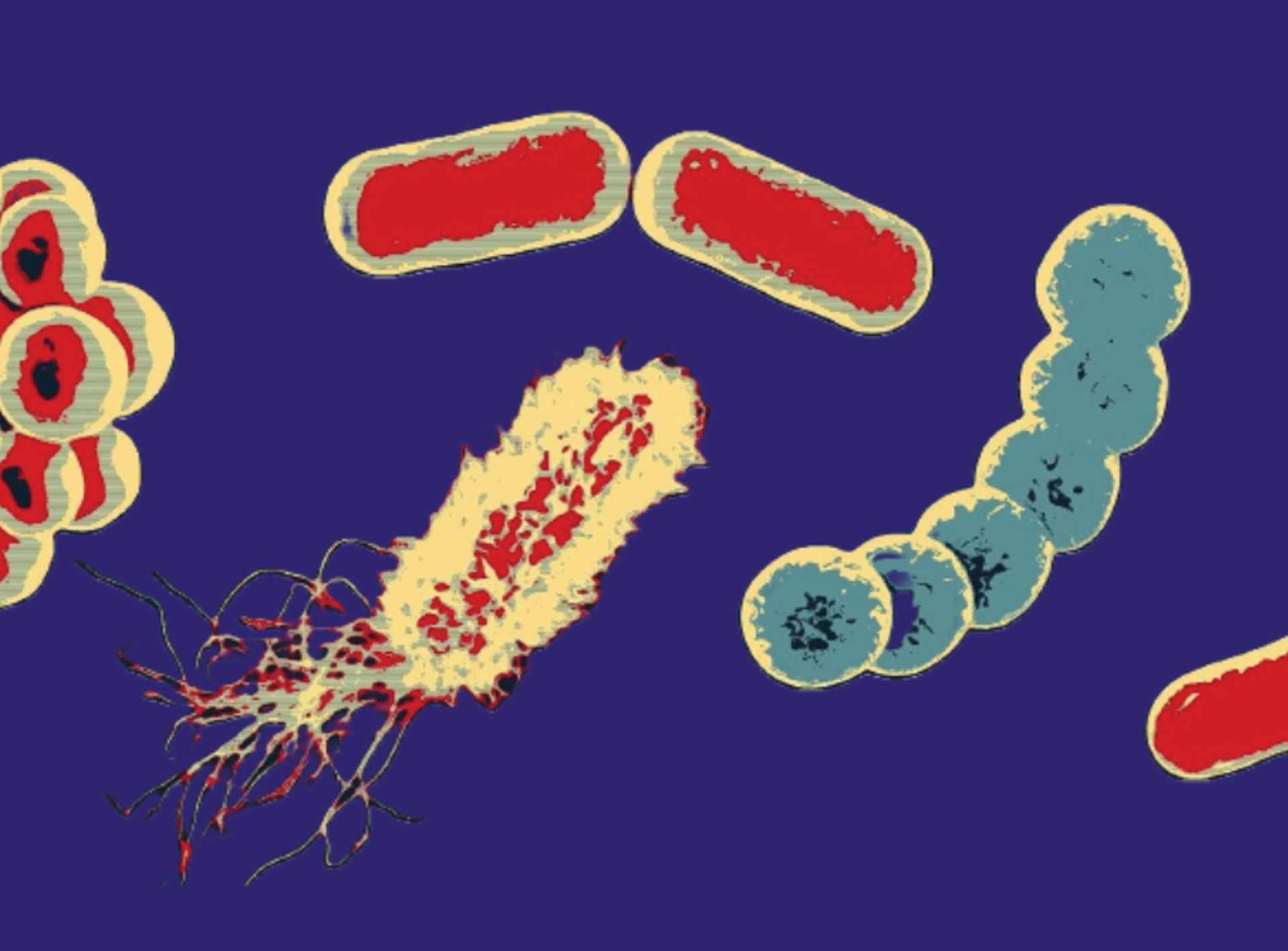 DxM MicroScan WalkAway System | SelectScience