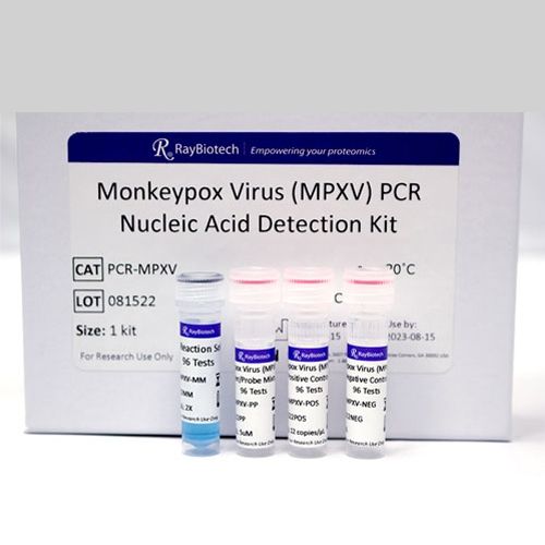 Monkeypox Virus Real-Time PCR Kit | SelectScience