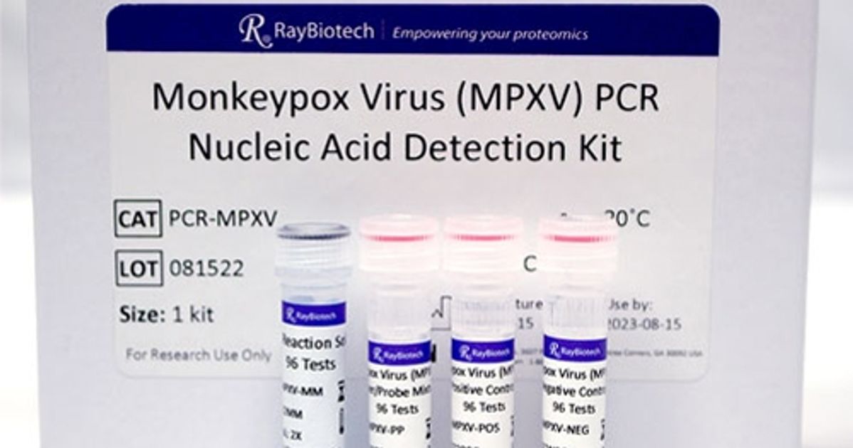 Monkeypox Virus Real-Time PCR Kit reviews