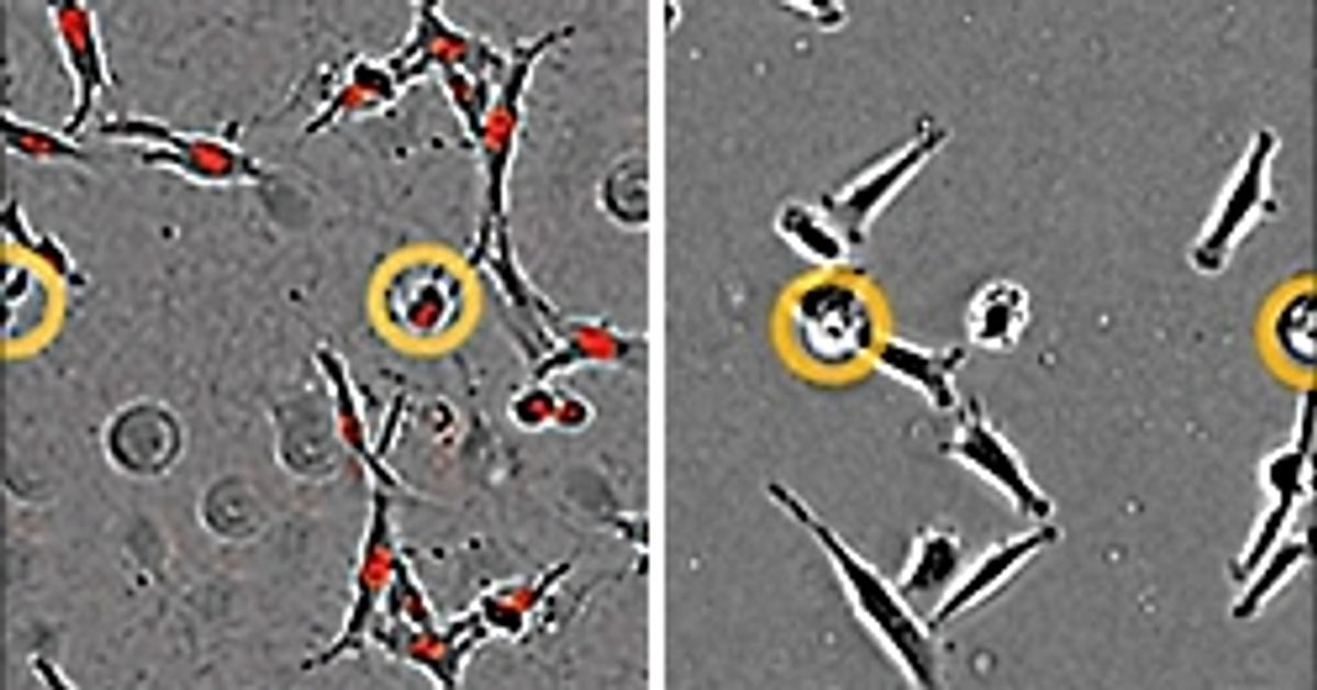 Incucyte® Chemotaxis Cell Invasion & Migration Software reviews